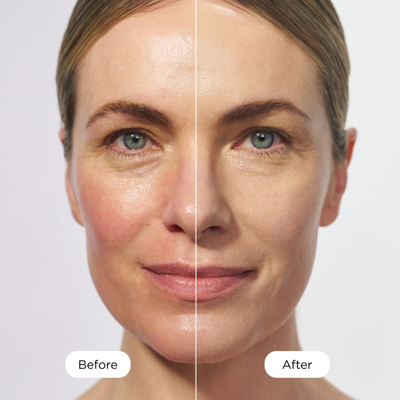 Calm & Correct 4-in-1 Colour-Correcting Treatment – Tropic Skincare